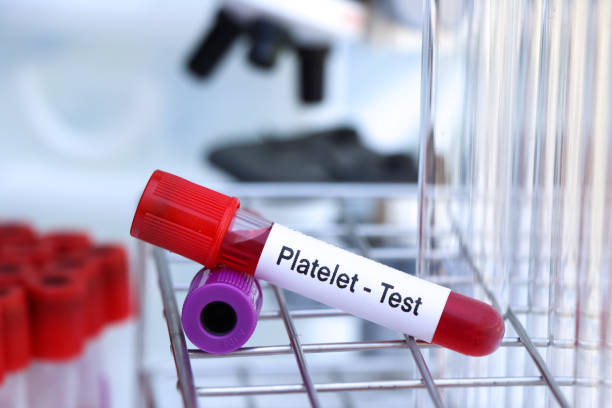 PDW Blood Test: Understanding Platelet Distribution Width – MyDiagnostics